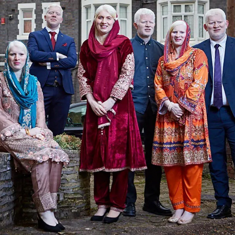 Un nou record Guinness a fost obtinut de o familie de albinosi din ...